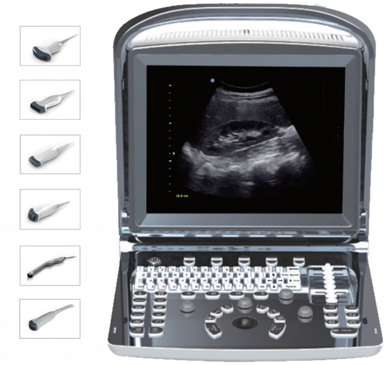 Digital Portable Ultrasound with Led Monitor – Juniper 3